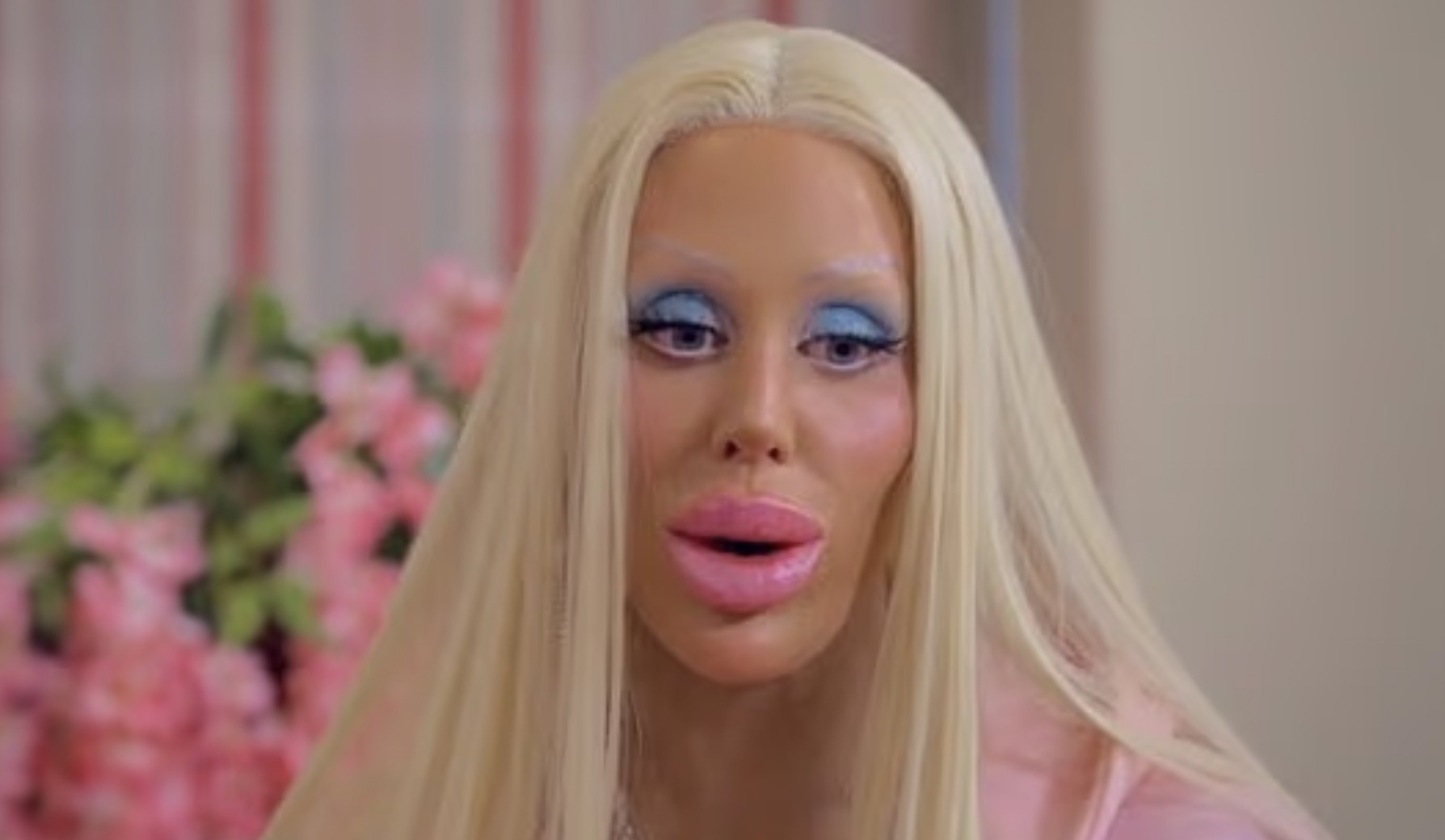 Woman who spent $320k on plastic surgery shows what she looked like ...